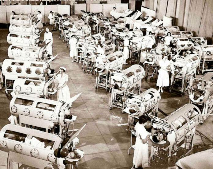 Poliomielitis: terrible y devastadora enfermedad - MegaCLUB