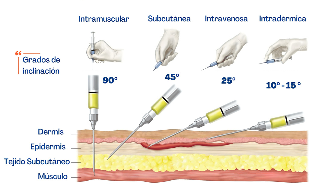 Inyectables: Protocolos en farmacias - MegaCLUB